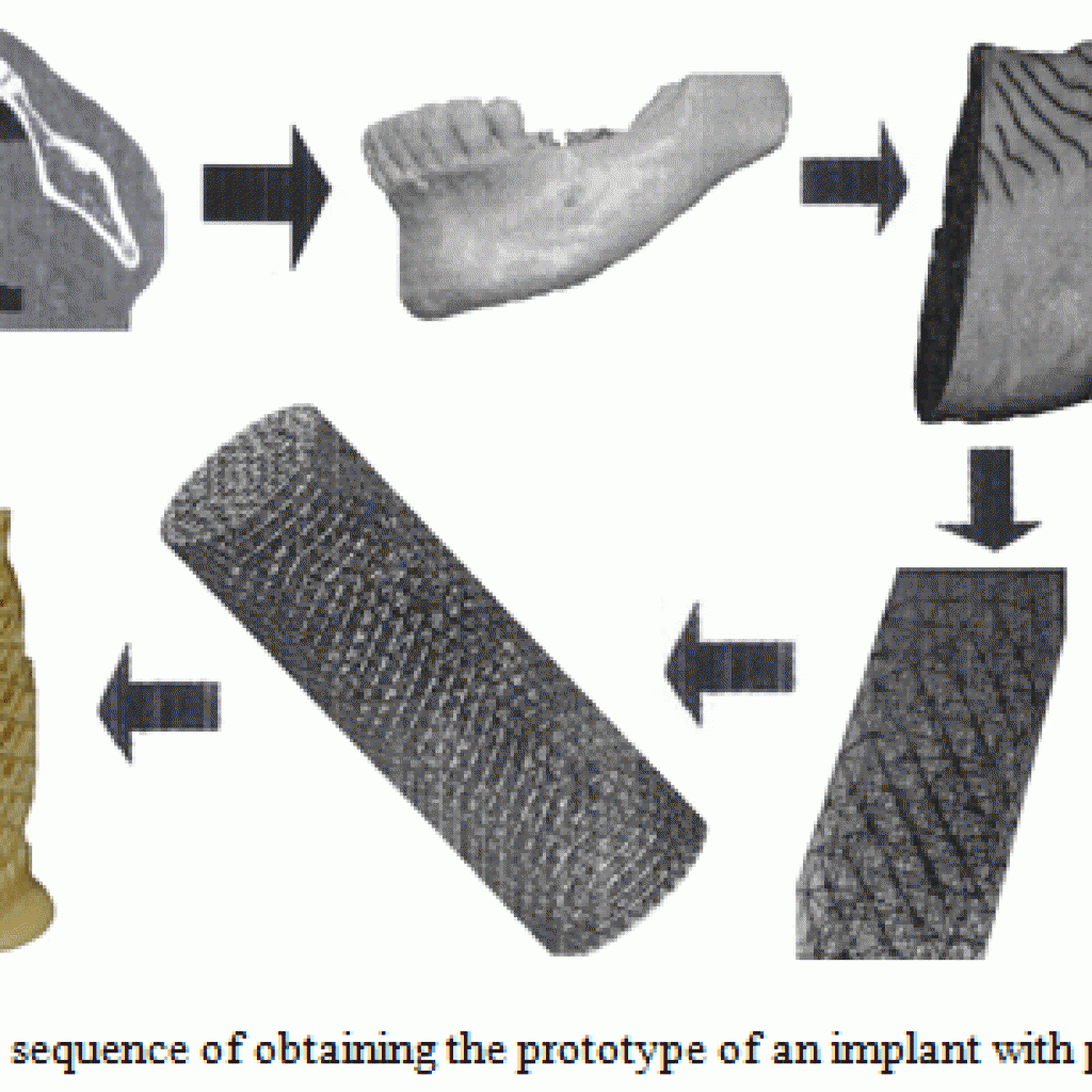 Synthesis of Jaw Implants with Porous Structure on the Basis of ...