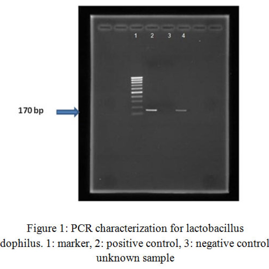 Lactobacillus Acidophilus and Assessment for its Antiviral Effect ...