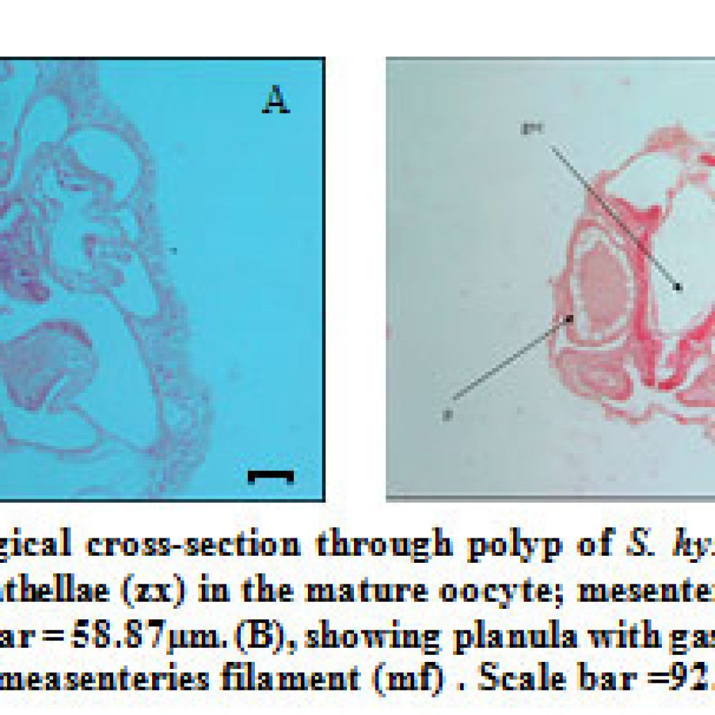 Sexual Reproduction of Two Reef Building Corals Seriatopora hystrix and ...