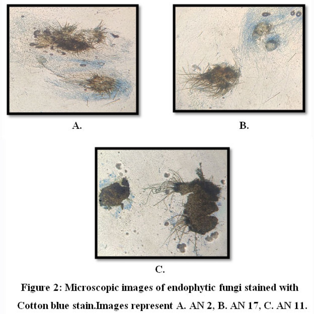 Diversity and Molecular Characterization of Endophytic fungi associated ...