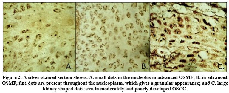 Prognostic Potential of Argyrophillic Nucleolar Organizer Regions ...