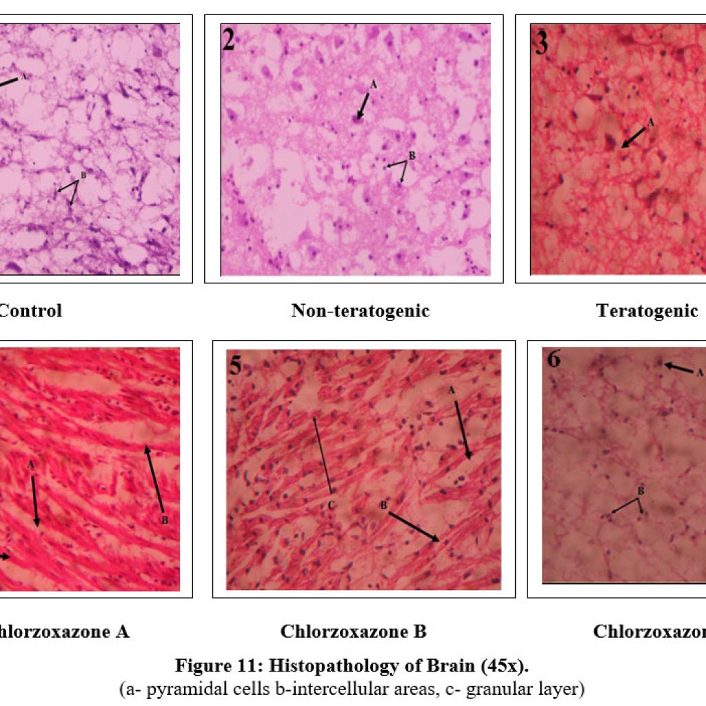 Toxicity Study of Chlorzoxazone and Isosorbide Dinitrate using Chick ...