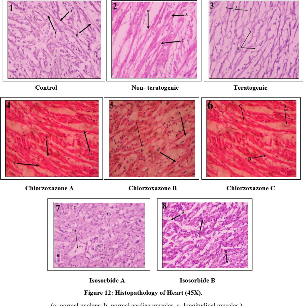 Toxicity Study of Chlorzoxazone and Isosorbide Dinitrate using Chick ...