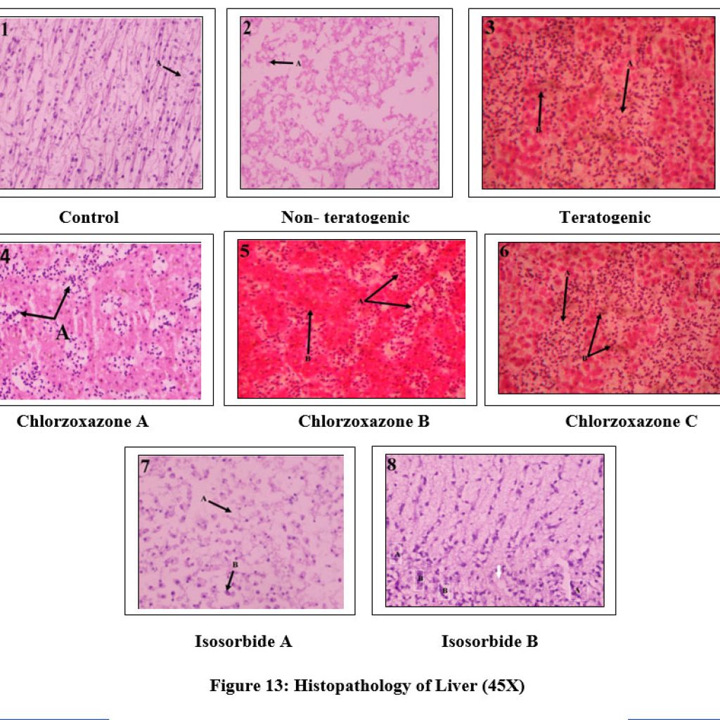 Toxicity Study of Chlorzoxazone and Isosorbide Dinitrate using Chick ...