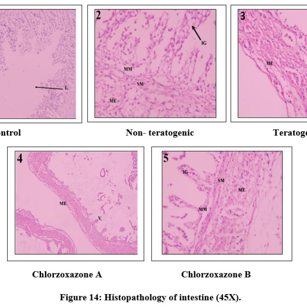 Toxicity Study of Chlorzoxazone and Isosorbide Dinitrate using Chick ...