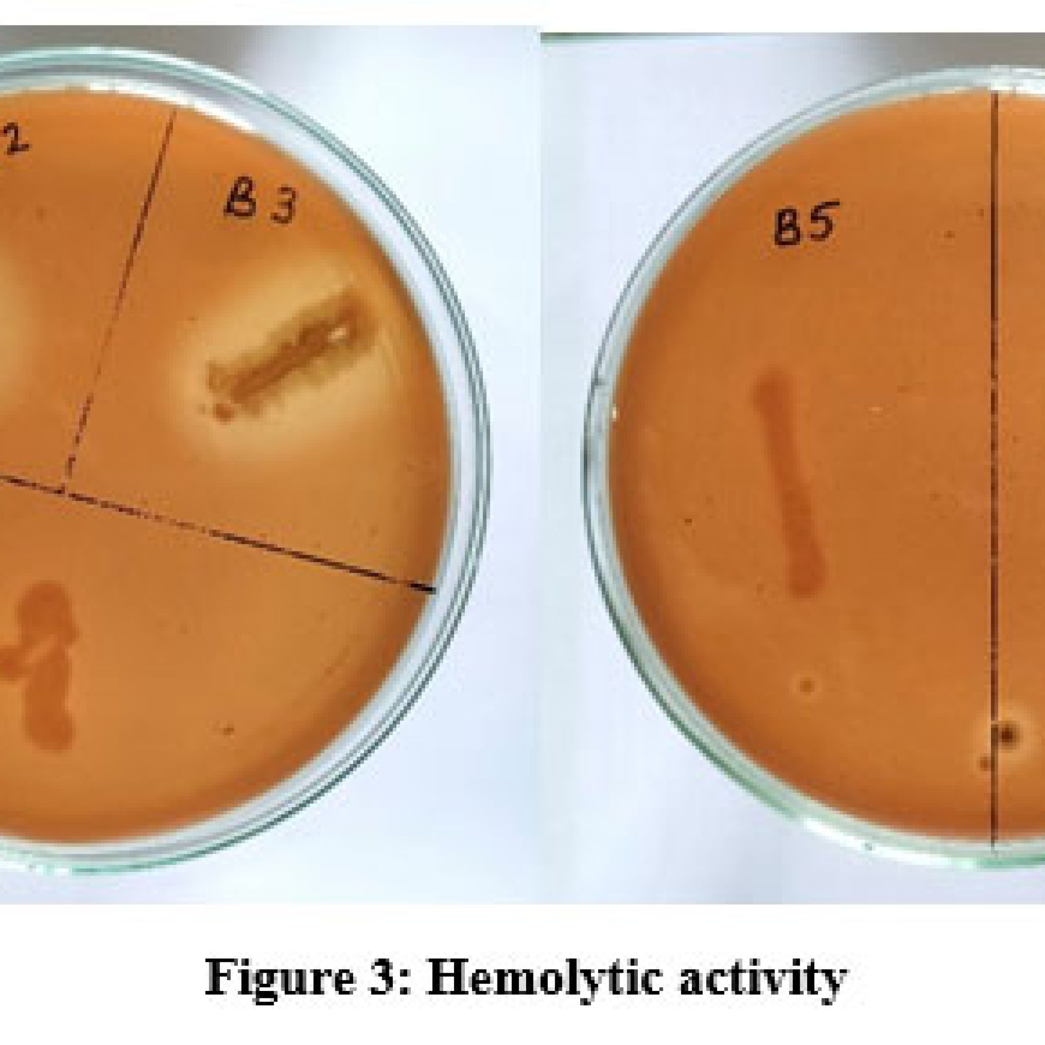 Diversity and Distribution of Potential Biosurfactant Producing ...