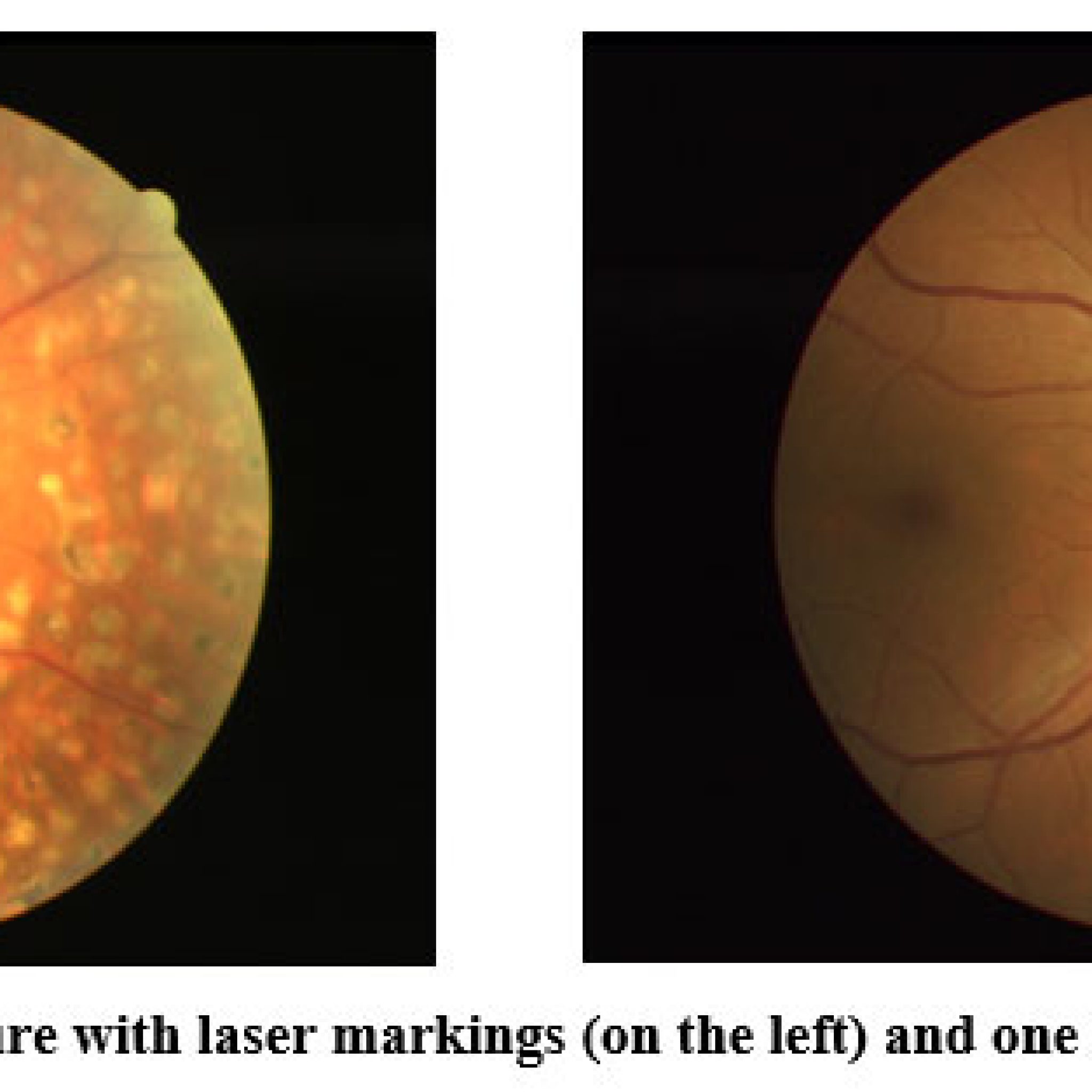 Intelligent Application of Laser for Medical Prognosis: An Instance for ...