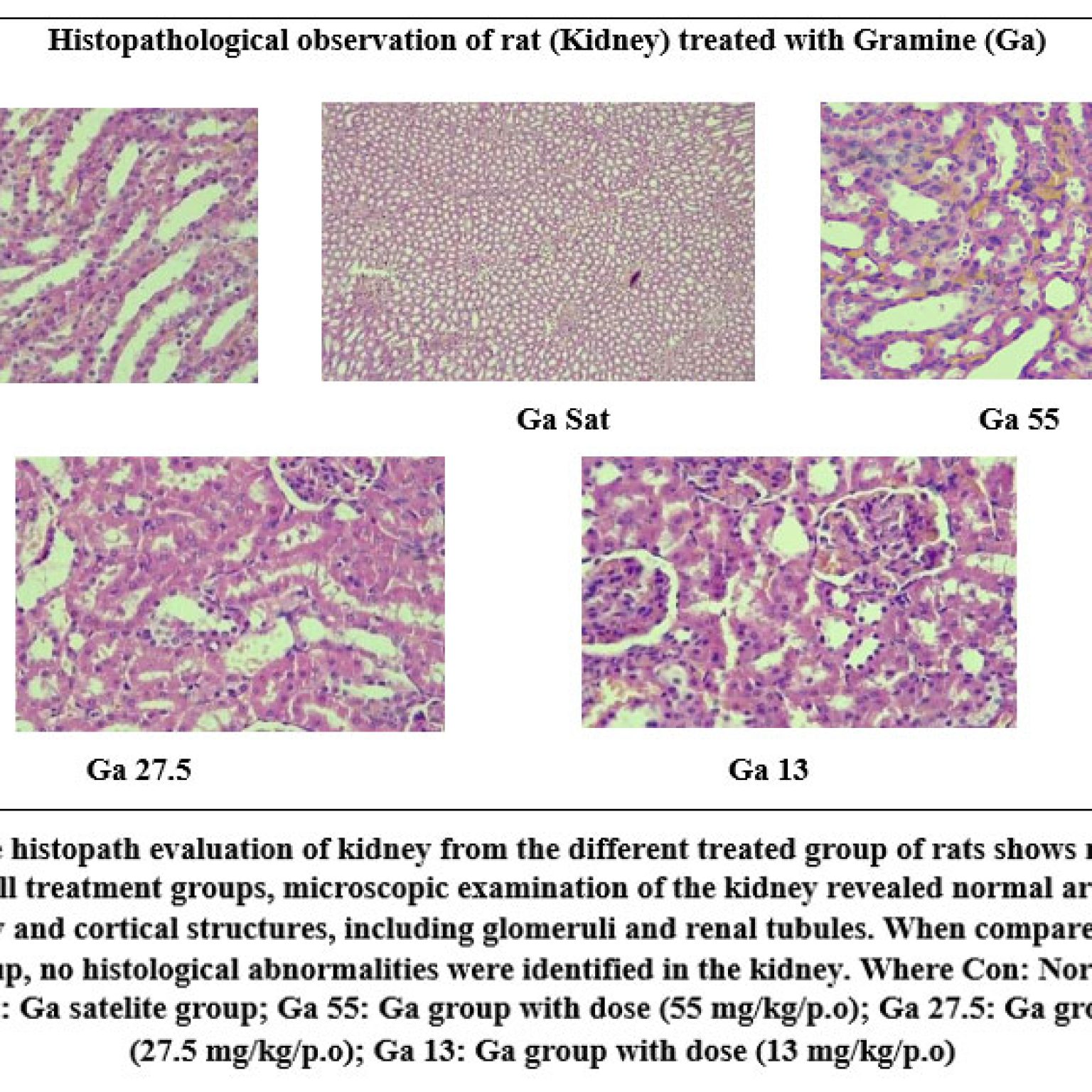 Exploring Acute and Sub-Acute Toxicity of Gramine Bioactive Molecule in ...