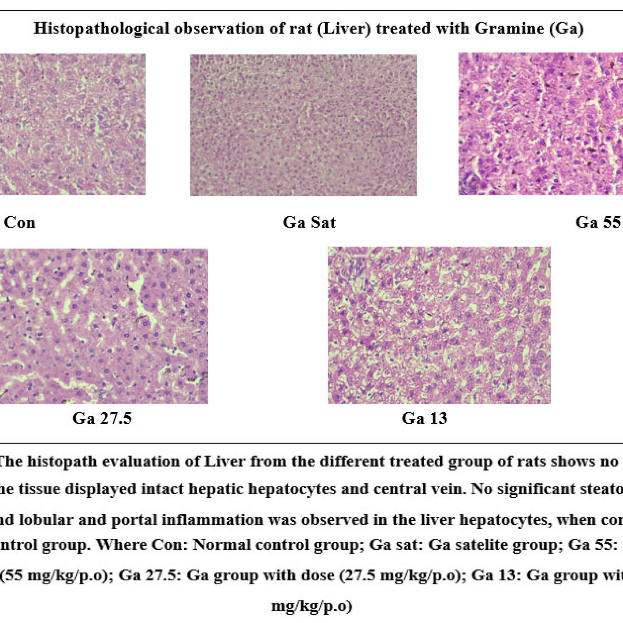 Exploring Acute and Sub-Acute Toxicity of Gramine Bioactive Molecule in ...
