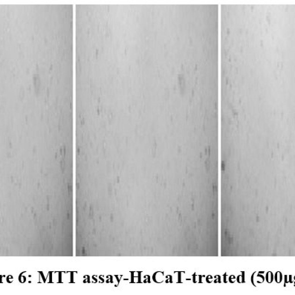 Antioxidant and Anticancer Activity Assessment of N. Oleander on the ...
