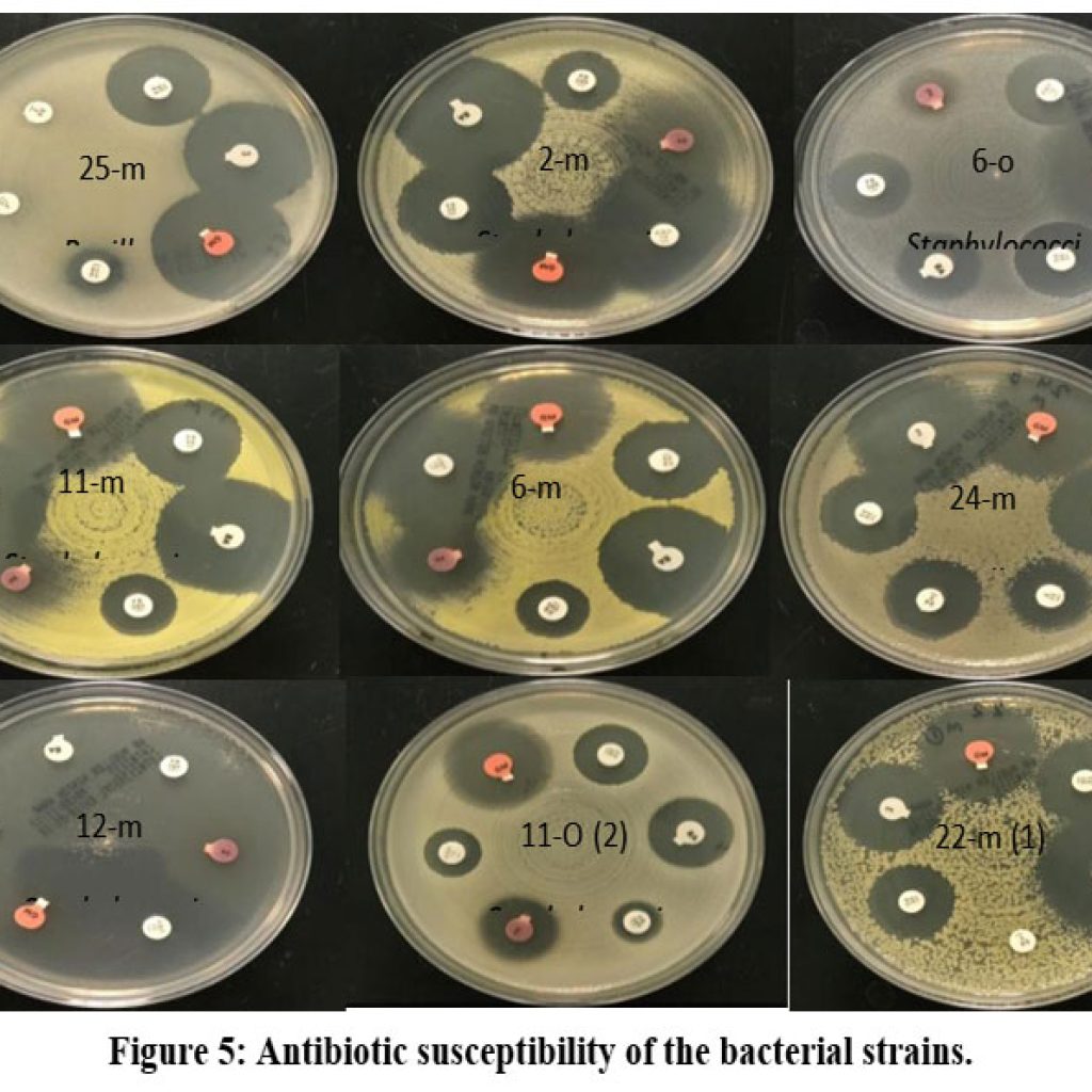 Prevalence of Drug-Resistant Nosocomial Pathogenic Bacterial Strains ...