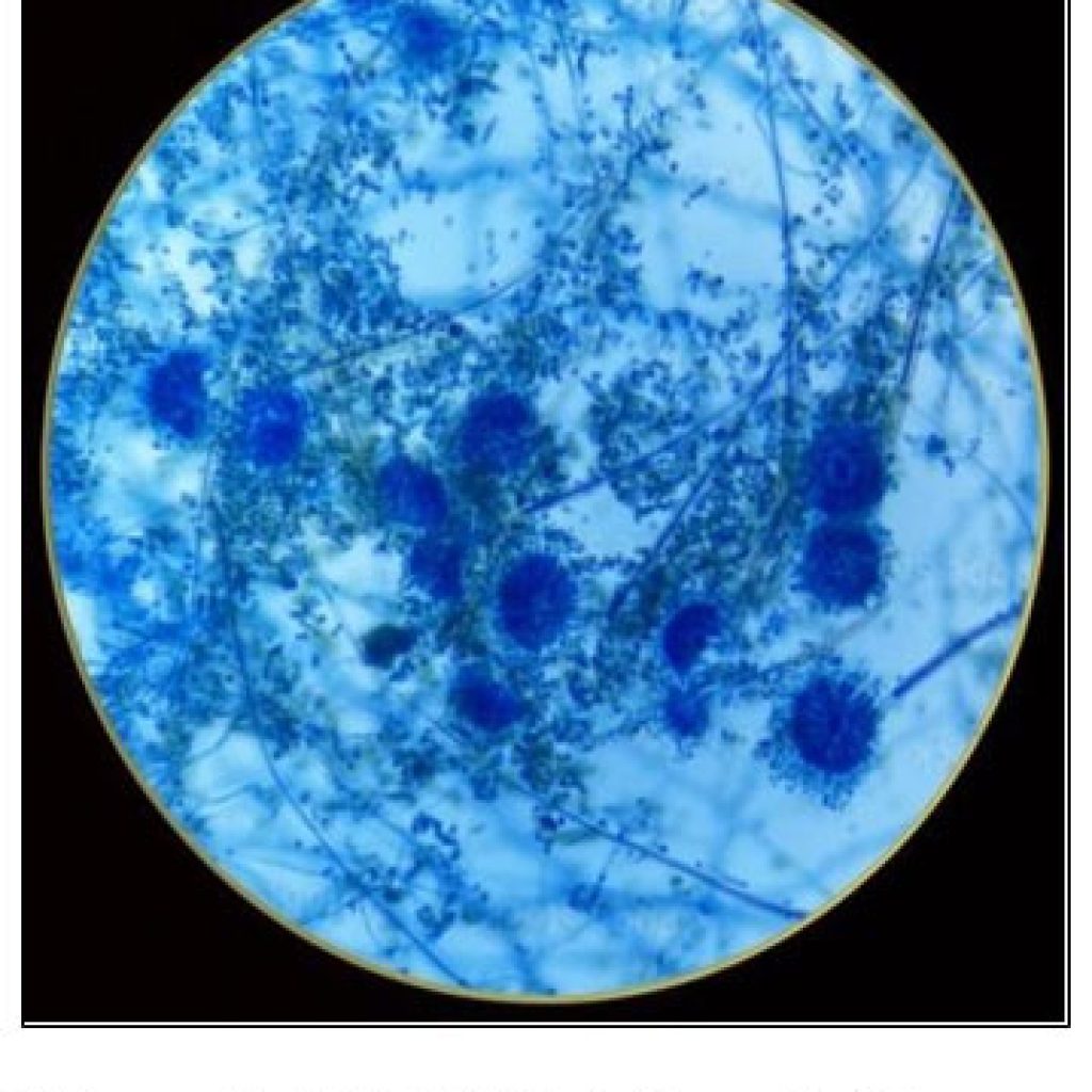 A Comprehensive Study of Aspergillus Oryzae-Derived Bioimmunostimulants ...